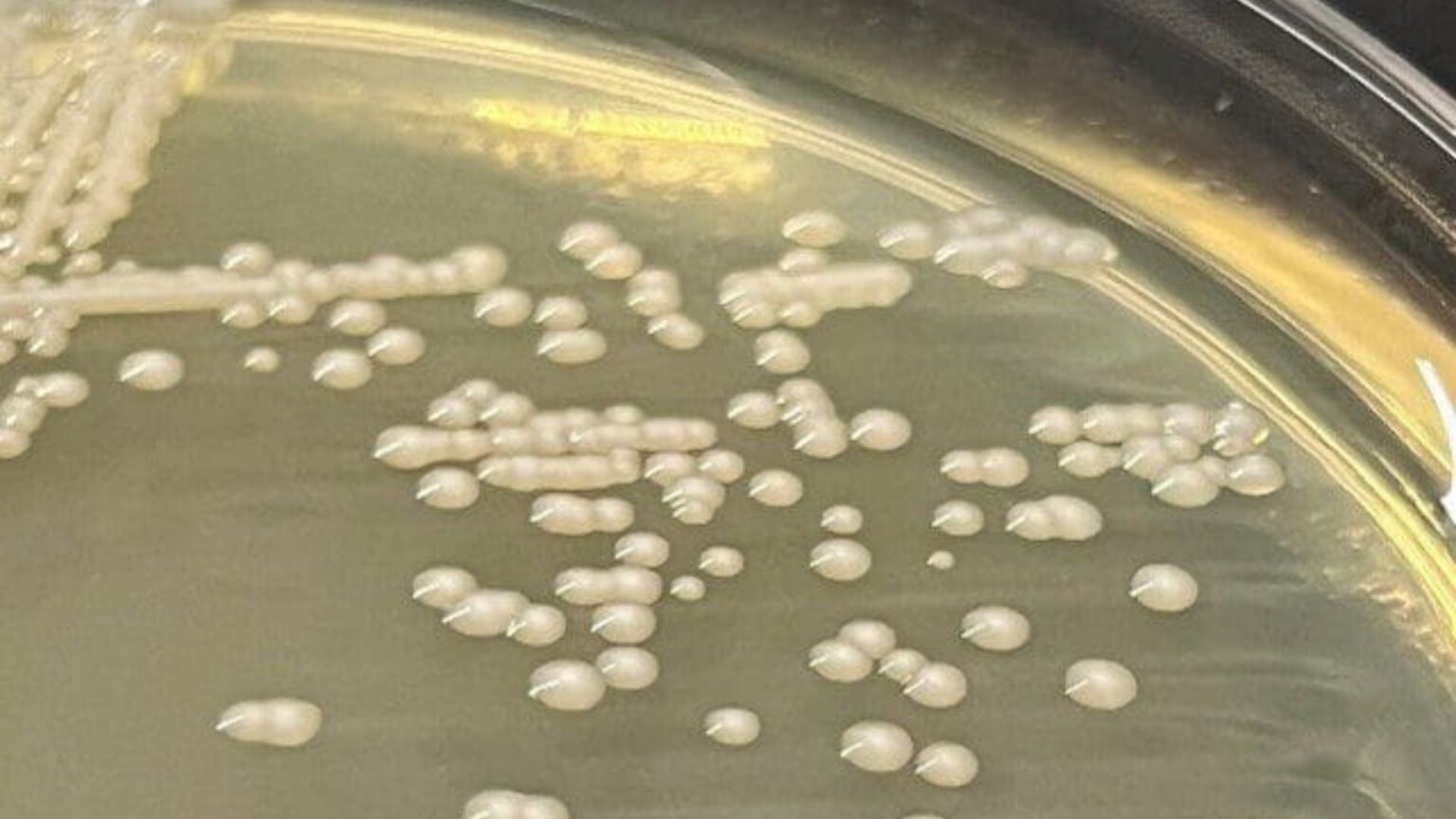 Neutrogena Recalls Makeup Wipes After FDA Detects Harmful Bacteria ...