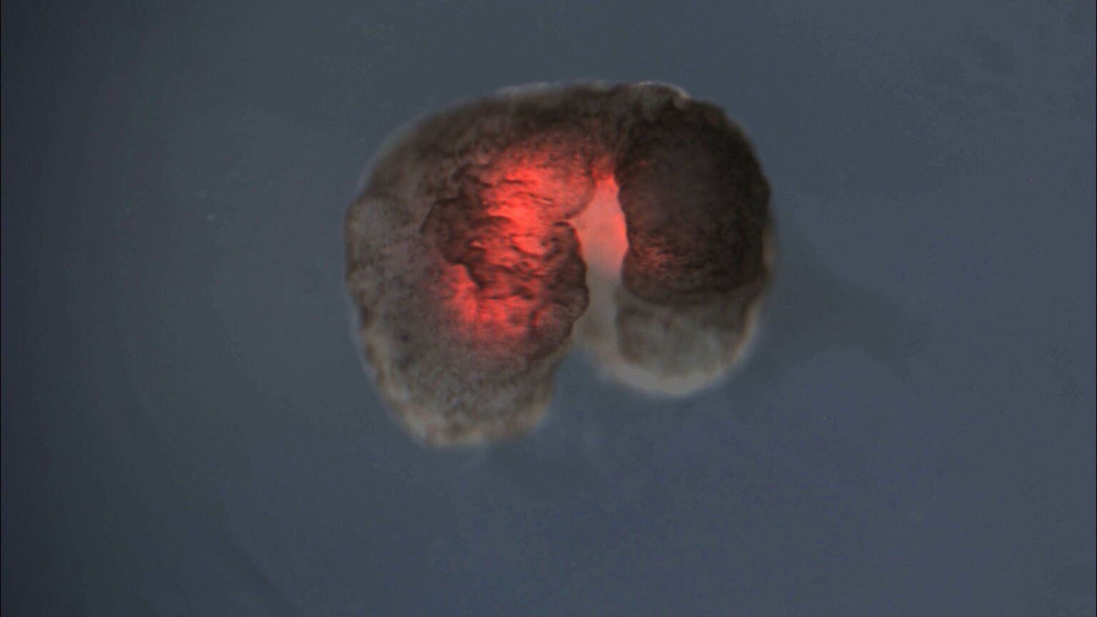 A 'Frankenstein' Third State Between Life and Death Has Been Confirmed ...