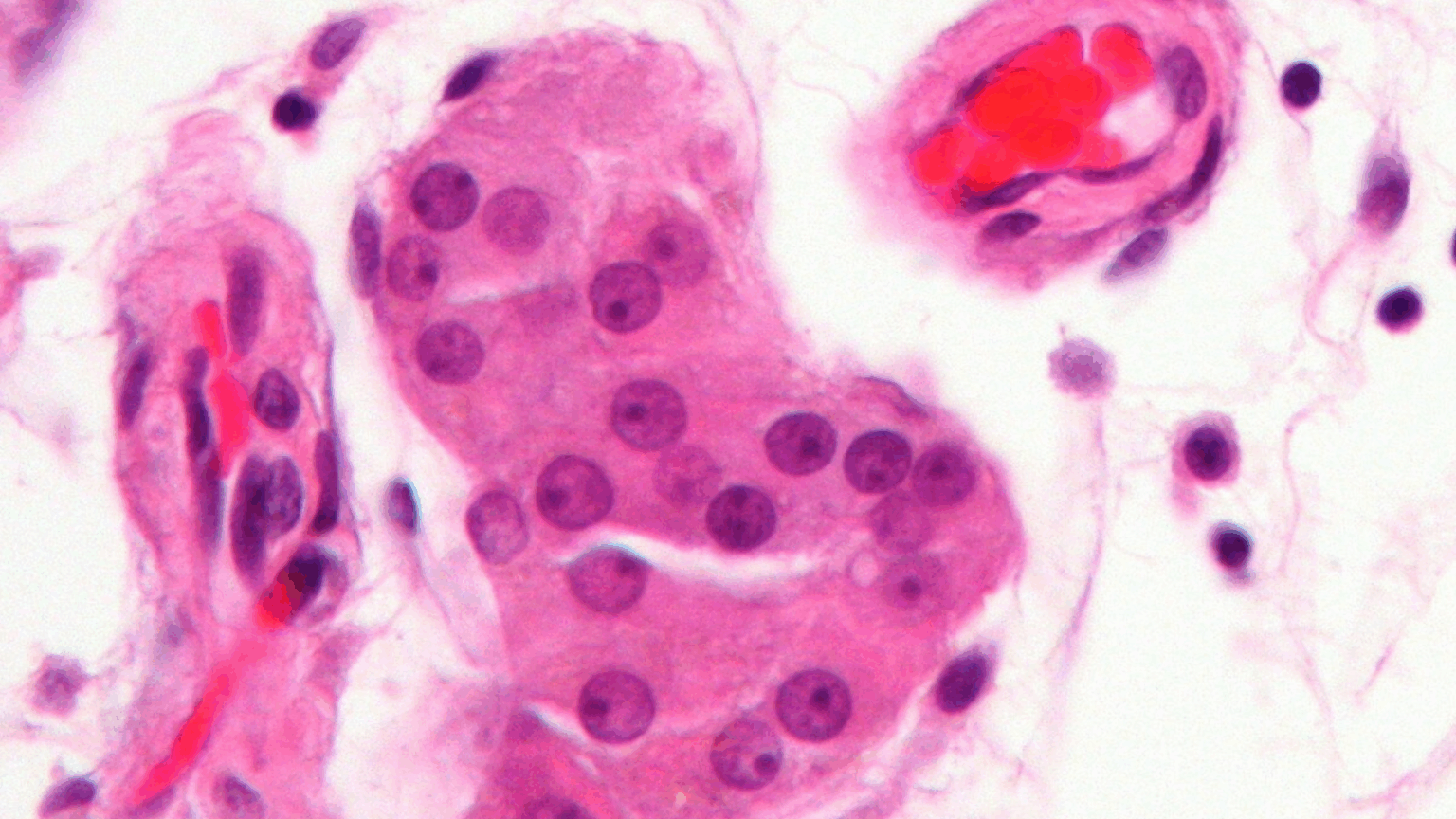 Nearly 200 Children Were Conceived Using Sperm From a Donor With a ...